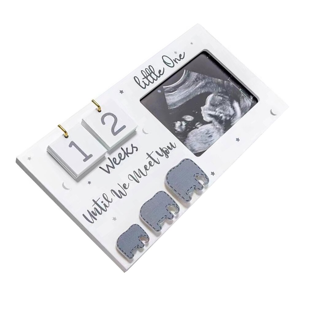 Детская Ультразвуковая Фоторамка Сонограмма Фоторамка Подарок При Беременности Объявление О Рождении Ребенка Сувениры На Память Для Пары Молодых Мам