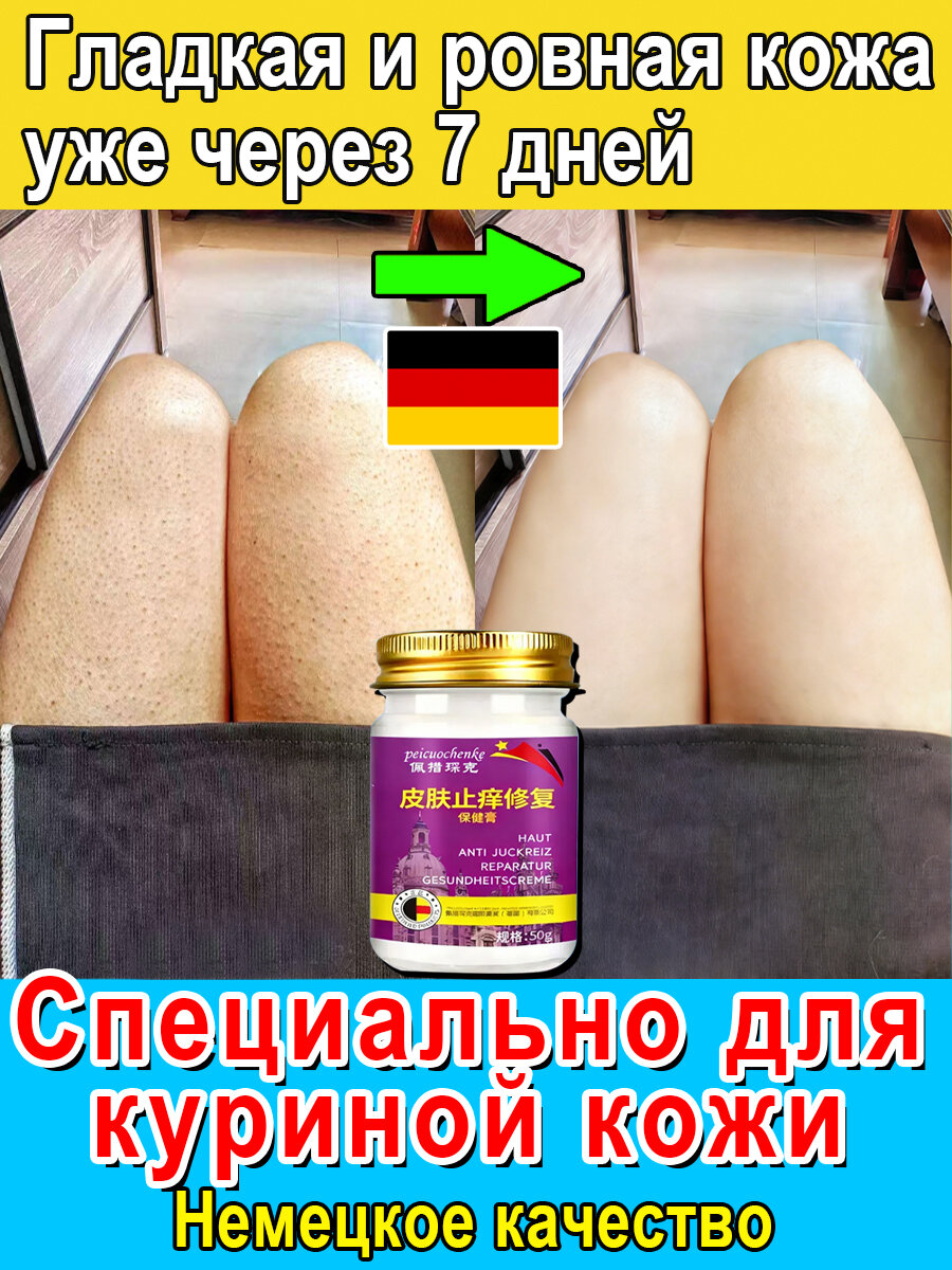 Крем для тела от гусиной кожи и сухости, ног и тела от трещин, кератоза, сухой и гусиной кожи55ml