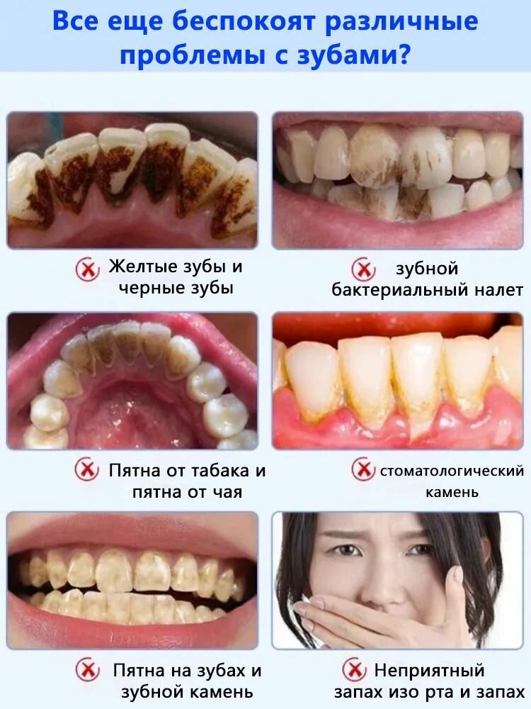 Отбеливающая зубная паста с лизоцимом, удаление налёта и зубного камня, свежесть дыхания и уход за деснами — фото 1