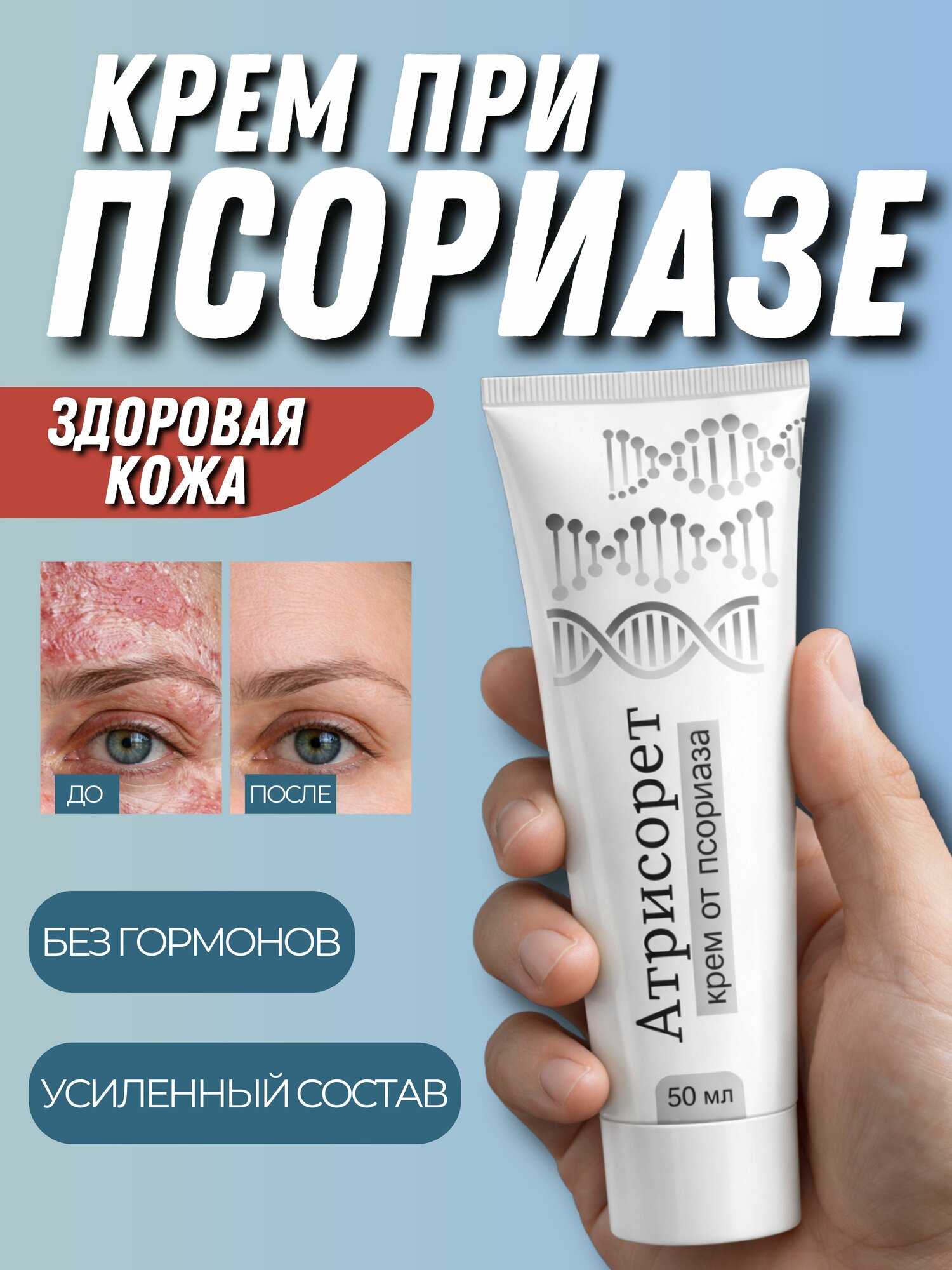 Комплекс от псориаза "Атрисорет"