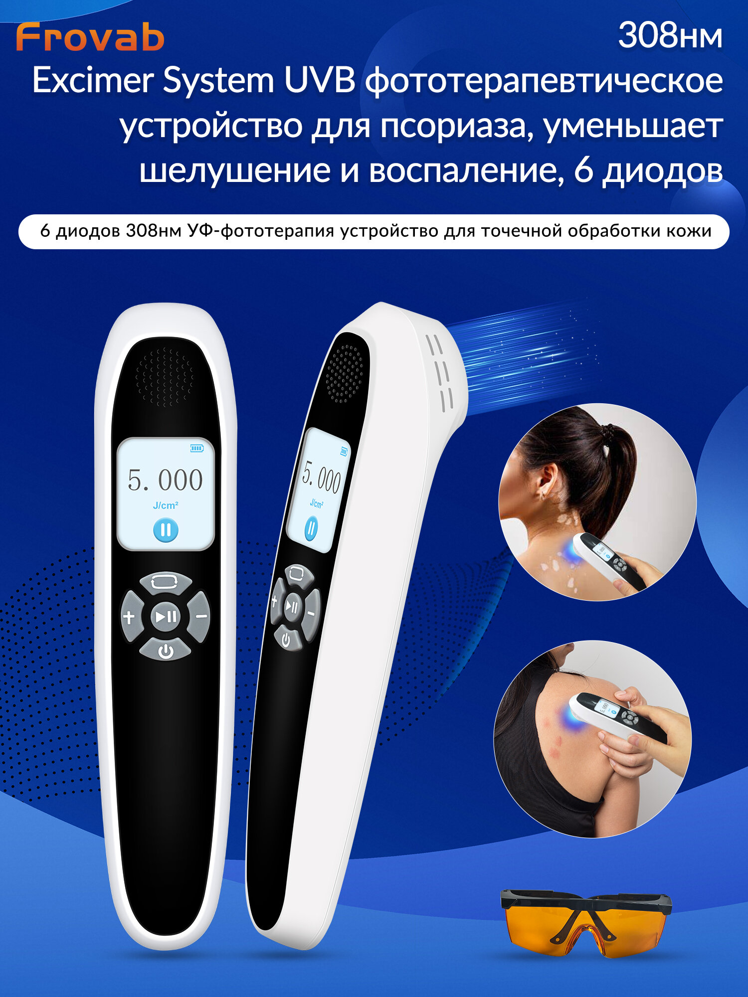 Портативный УФ-аппарат Frovab 308нм, 6 диодов, от псориаза, витилиго и кожных заболеваний