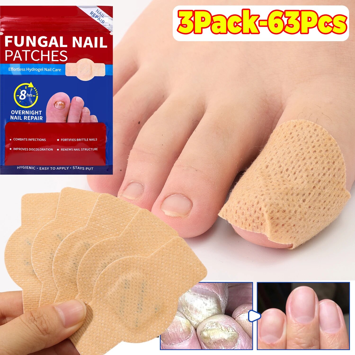 Патчи от грибка ногтей 3Pack-63pcs