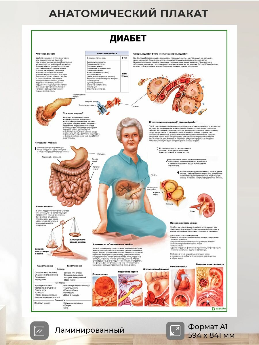 Обучающий медицинский плакат ламинированный формат А1 Диабет