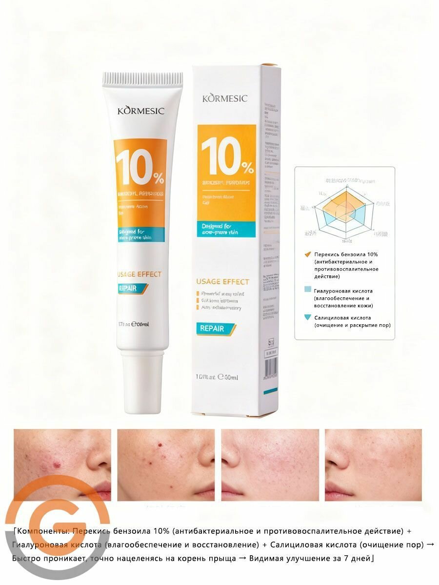 Kрем-гель против прыщей и акне, 10% Бензоил Пероксид