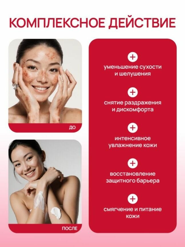 Psoriform: комплекс для поддержки кожи, мазь от бляшек, зуда и шелушения на коже, 50 мл