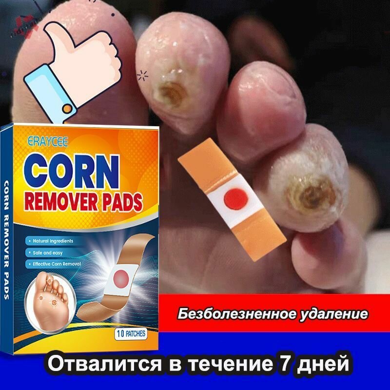 Пластырь от сухих мозолей и натоптышей,10 наклеек, Пластырь от сухих мозолей стержневых, бородавок, натоптышей, шипиц и пяточных шпор, лейкопластырь для стержневых мозолей от бородавок и шипиц для пяточных шпор
