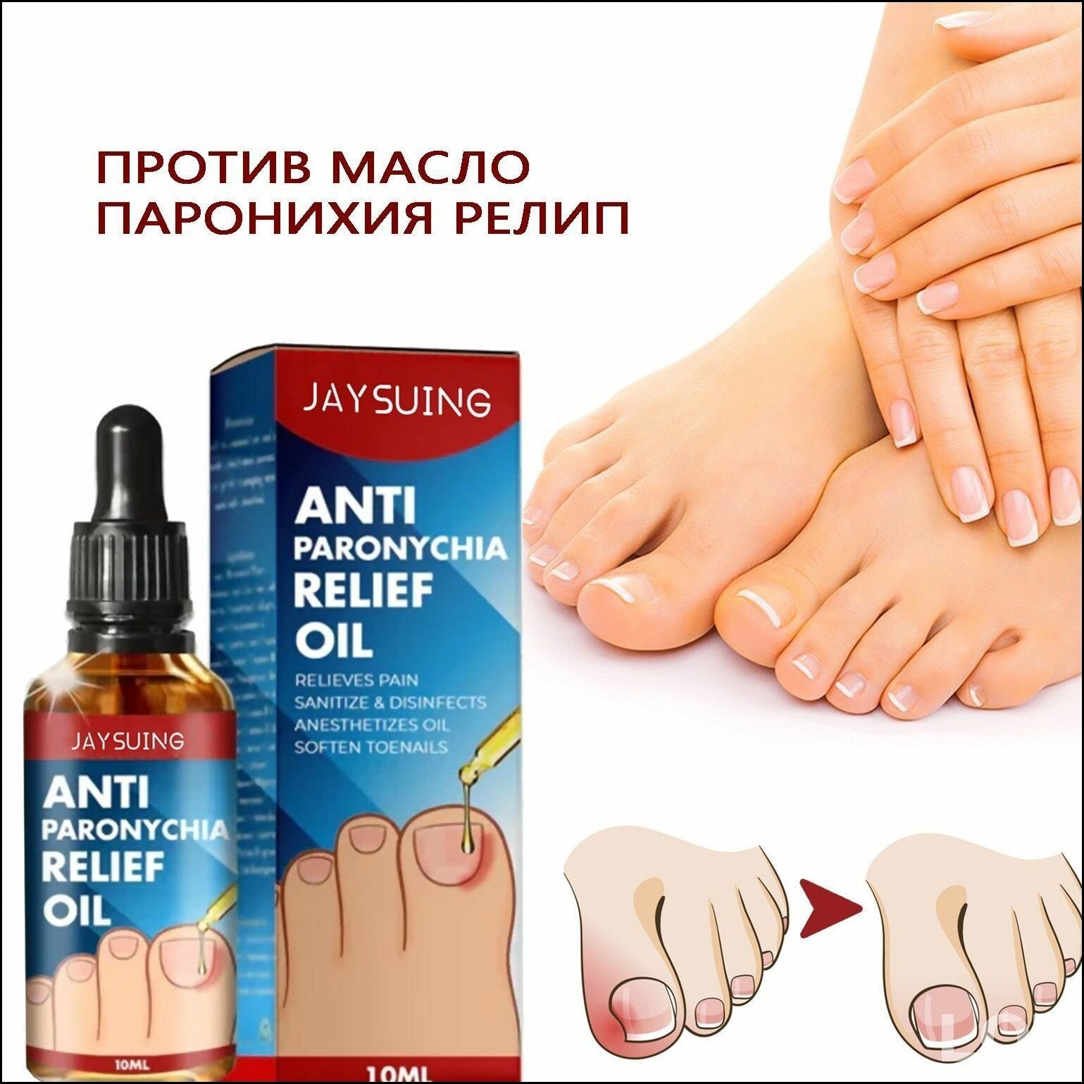 Капли для снятия вросшего ногтя на ноге с маслом для снятия боли