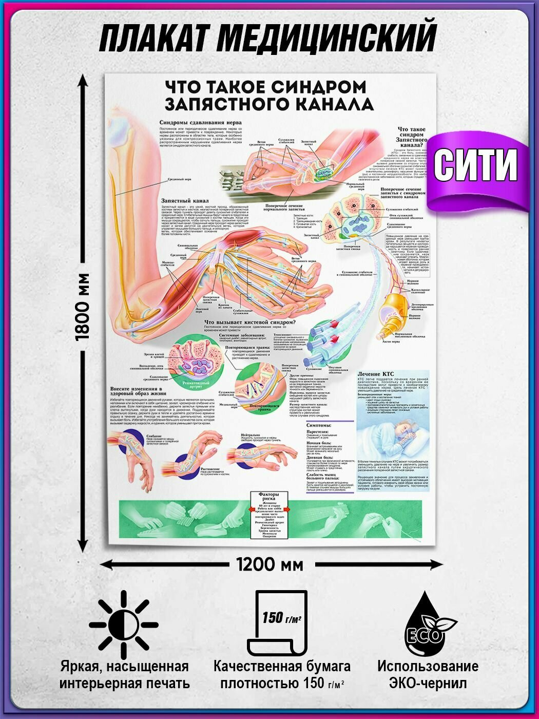 Информационный медицинский плакат "Синдром запястного канала" / Формат сити (120х180 см.)
