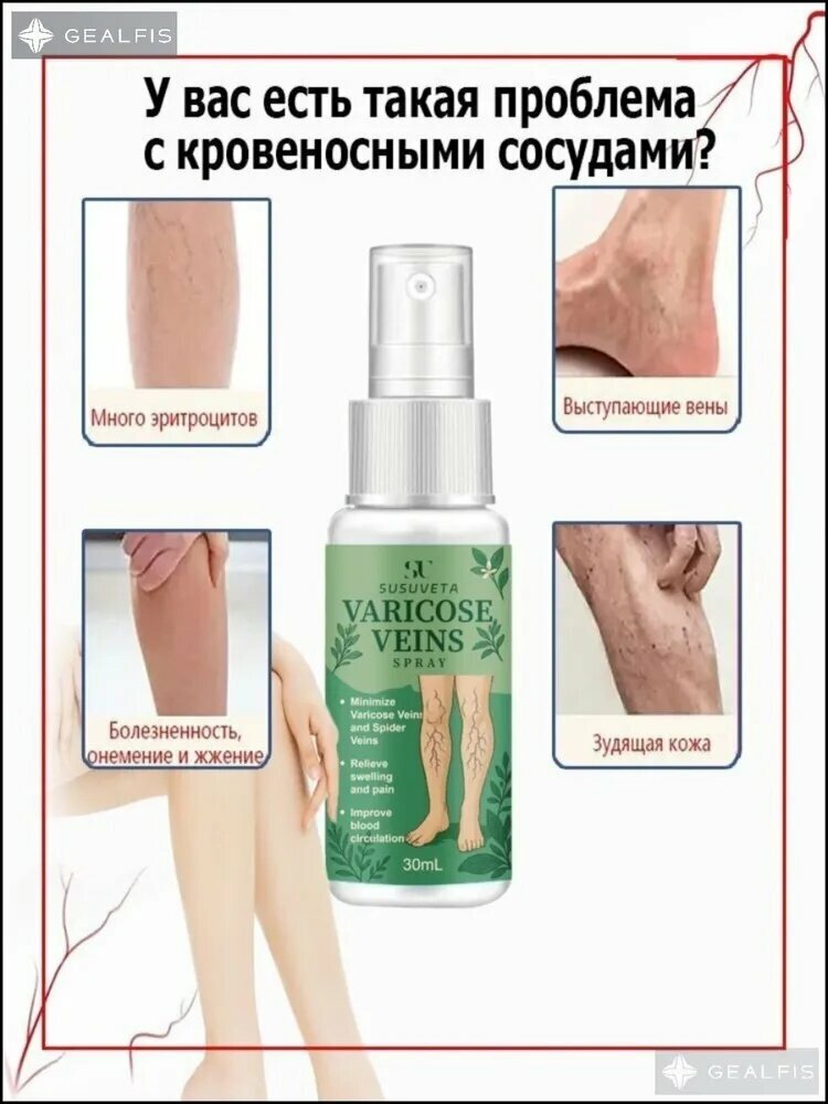 Средство от варикоза с натуральными растительными экстрактами, спрей для охлаждения ног, улучшает циркуляцию крови и снижает отечность ног, 30 мл