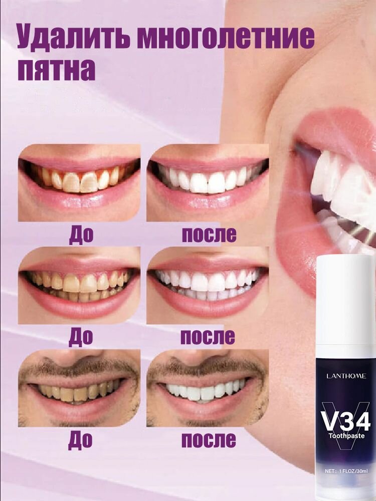 Зубная паста — фото 1