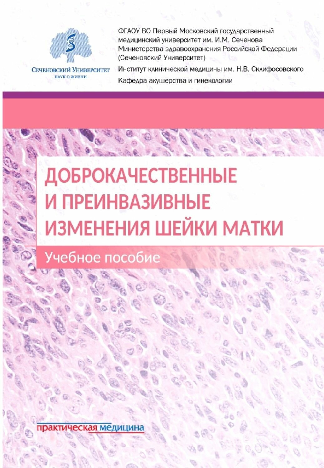 Доброкачественные и преинвазивные изменения шейки. Леваков