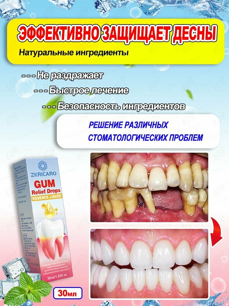 Натуральное масло для ухода за зубами. Эффективно устраняет рецессию десен, кровоточивость и воспаление; подавляет рост бактерий; защищает десны; удаляет зубной налет и пятна. 90 мл