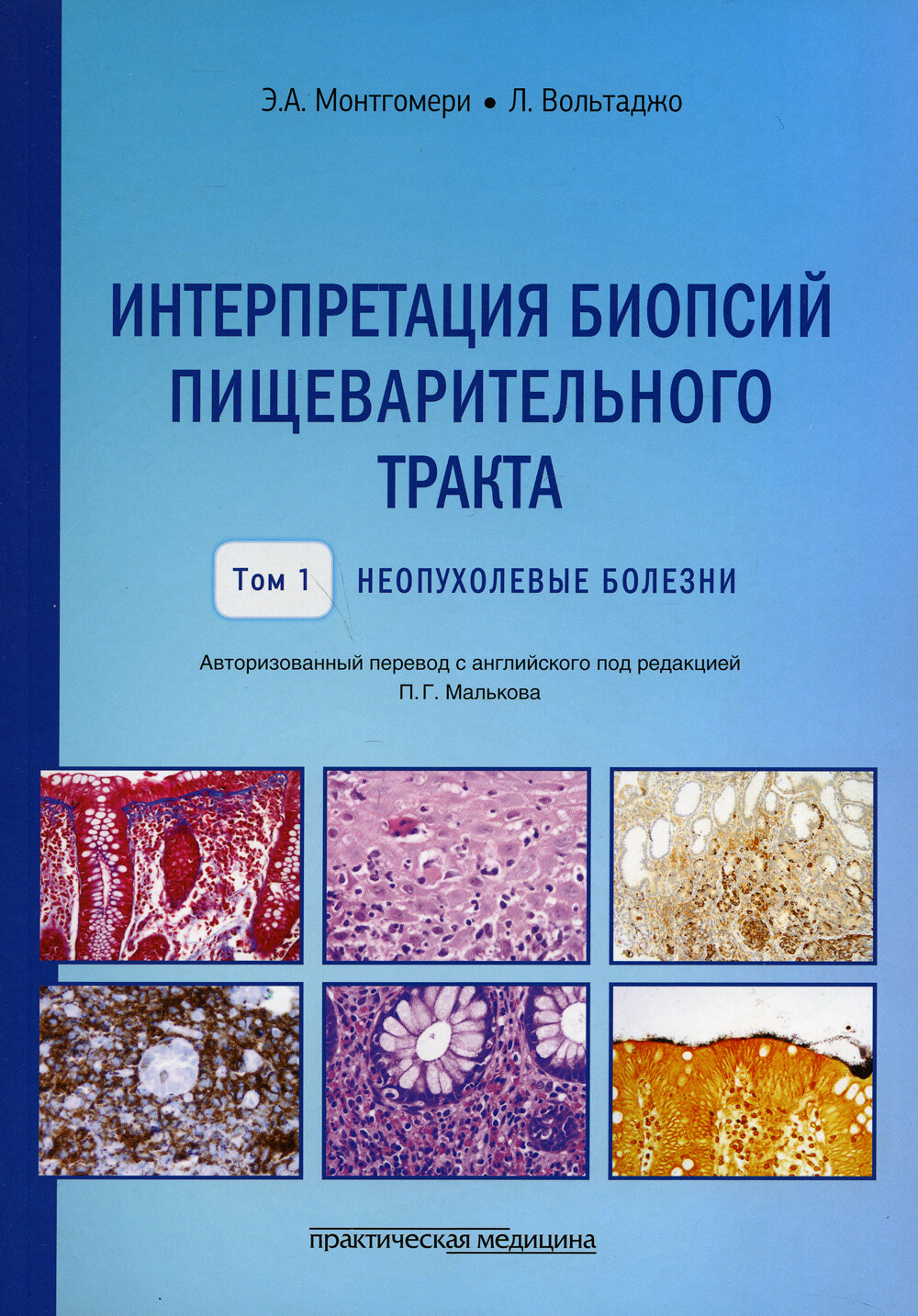 Интерпретация биопсий пищеварительного тракта. Т. 1: Неопухолевые болезни. Монтгомери Э. А, Вольтаджо Л.