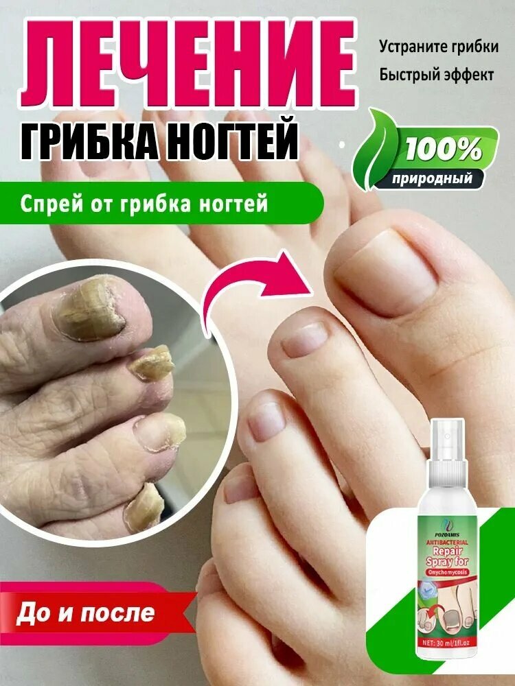 3 флакон 90 мл. Полностью излечивает онихомикоз рук и ног, подавляет рост грибков и способствует здоровому росту ногтей.