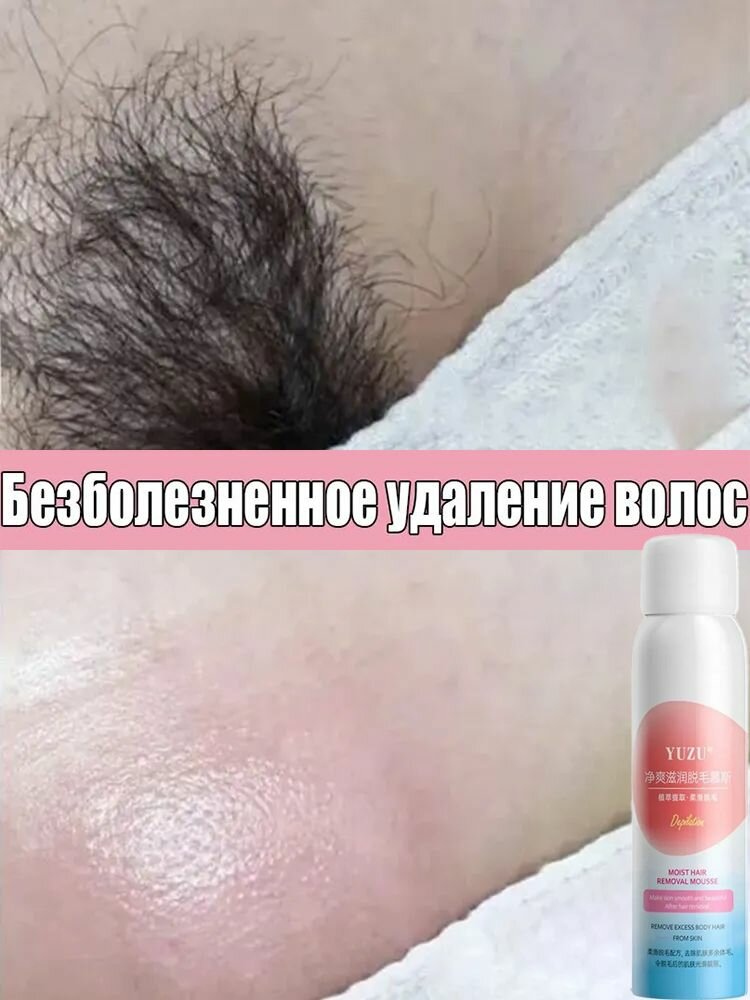 Спрей для депиляции 150мл, быстрое и безболезненное удаление волос, Спрей для депиляции ног, рук, области бикини и подмышек для чувствительной кожи.