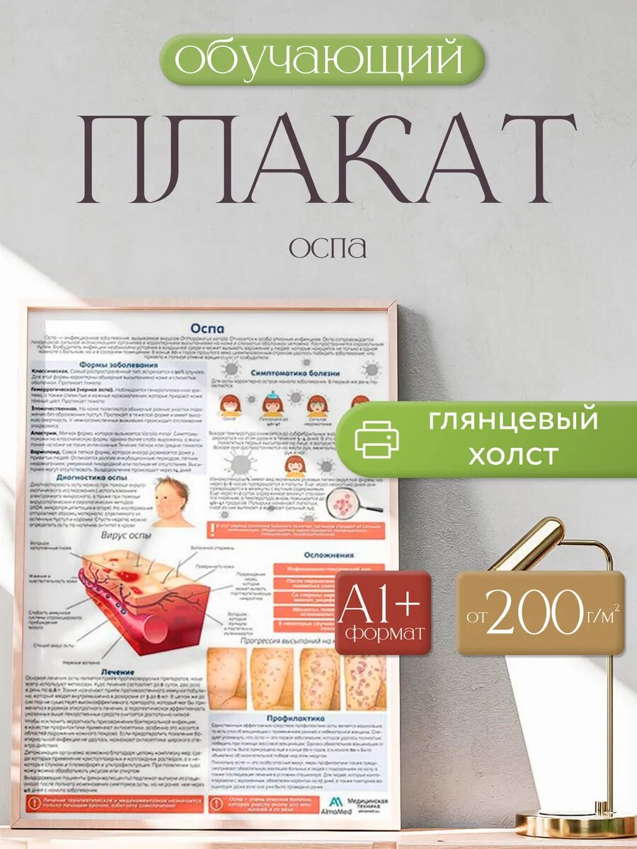 Оспа медицинский плакат глянцевый холст от 200 г/кв. м, размер A1+
