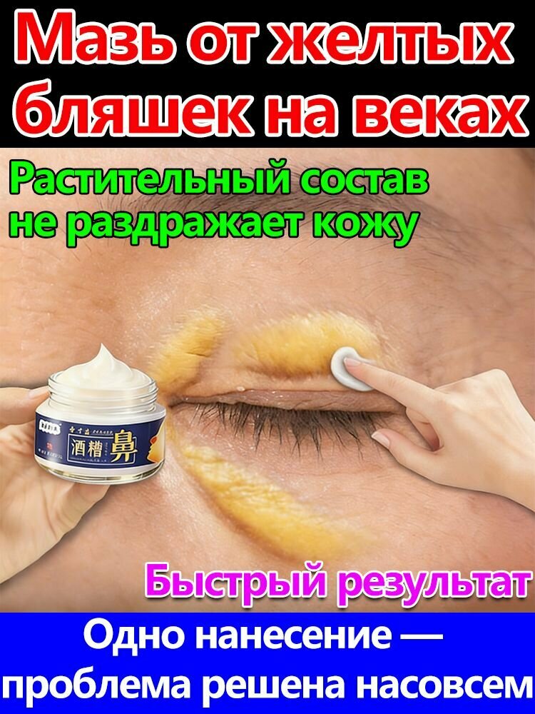 Мазь от ксантелазмы и ксантом на веках и лице. Лечение папул и желтых бляшек вокруг глаз. Эффективное средство против атеромы