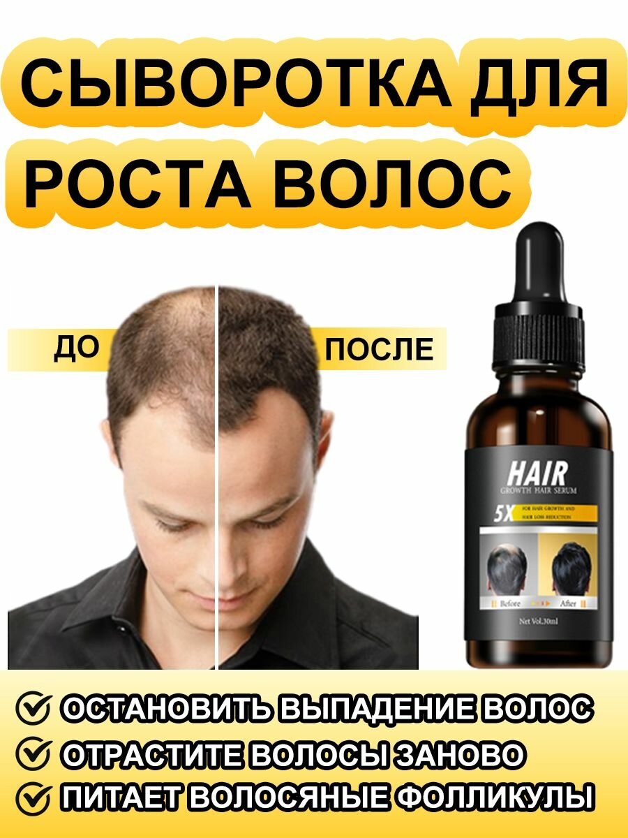 Сыворотка для роста волос, 30 мл, против выпадения волос, для женщин, рост бороды для мужчин