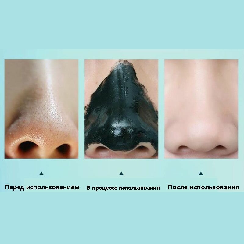 Очистите нос от прыщей, удалите угри, уменьшите размер пор, глубокое очищение, нежная очищающая грязевая маска