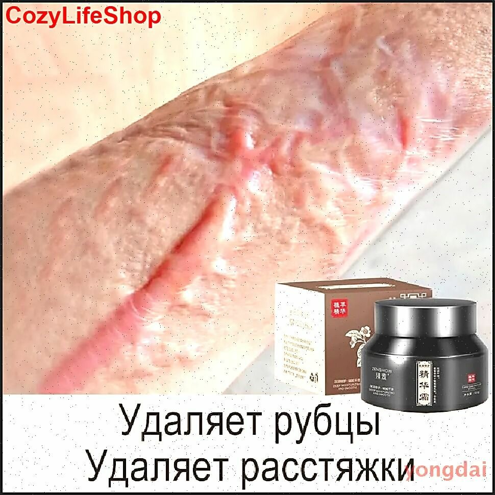 Крем для удаления шрамов. рубцов, растяжек для беременных и пигментации, без отдушек и легко впитывается, для лица и тела,50 г