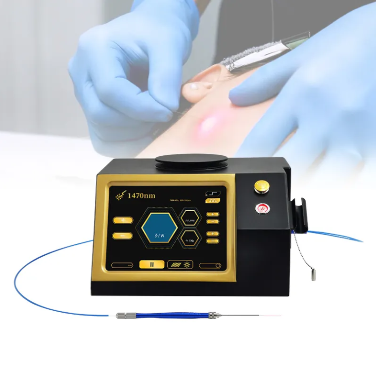 Эндоскопический лазерный прибор 1470 нм, диодный лазер для эндоскопии, повышение мощности лазера 1470 нм