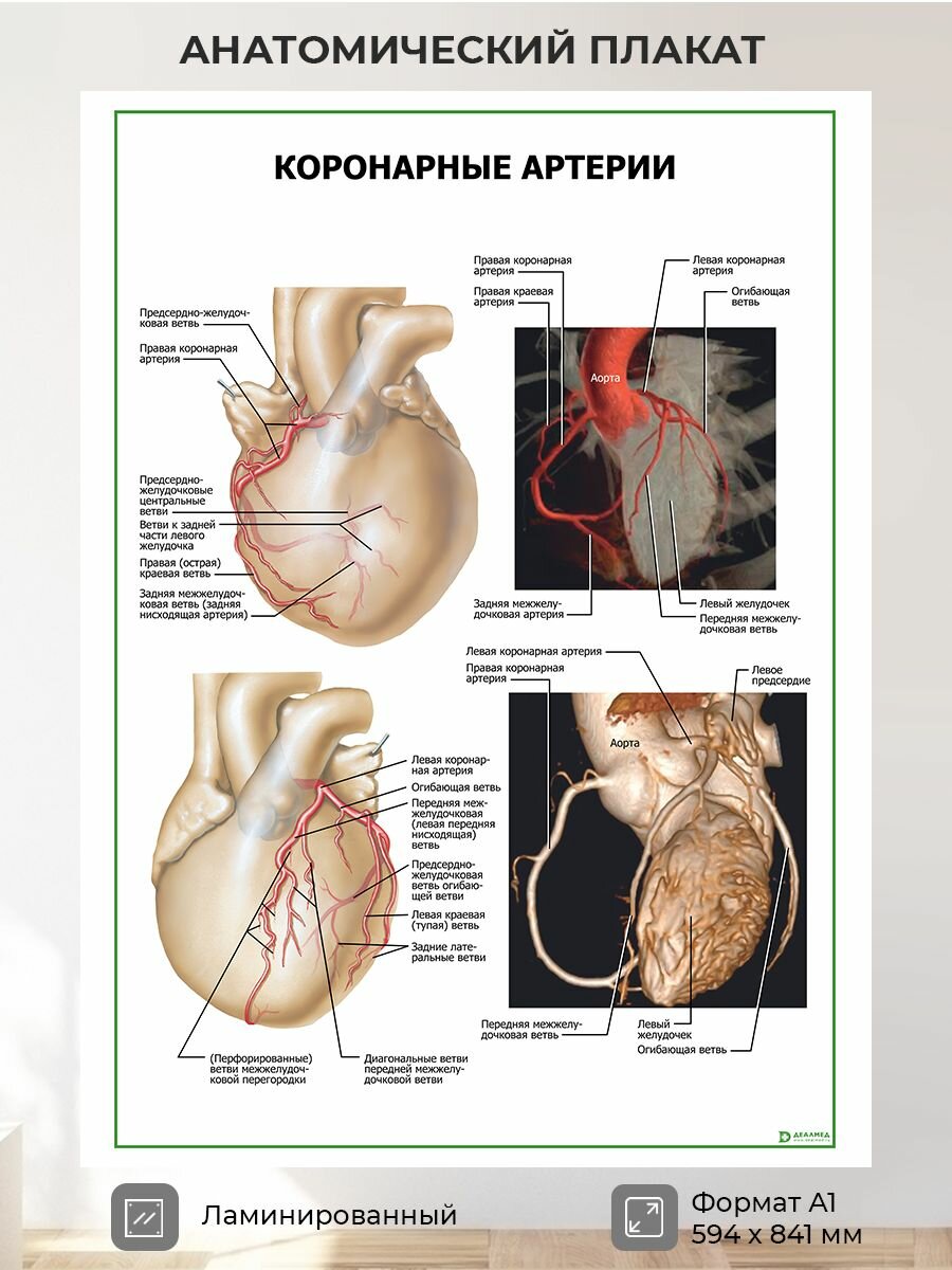 Обучающий медицинский плакат ламинированный формат А1 Коронарные артерии