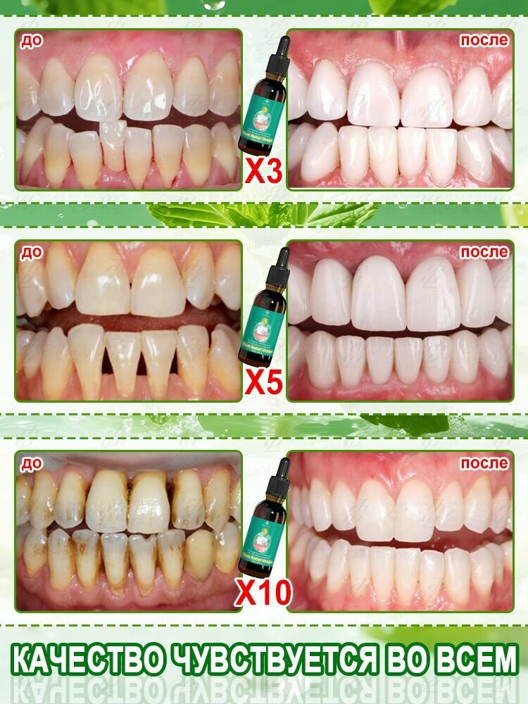 Эфирное масло для ухода за зубами. Быстро устраняет рецессию, покраснение и отёк дёсен, укрепляет корни зубов и снижает чувствительность зубов. Не раздражает слизистую оболочку полости рта. 30 мл.