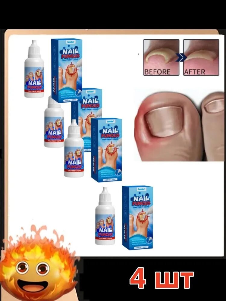 Лечение грибка ногтей на ногах/уход за ногтями 20 мл 4 шт