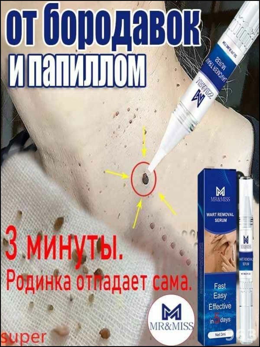 Эксклюзивный карандаш MR&MISS 3 мл для удаления папиллом, бородавок и родинок без боли, следов и побочных эффектов