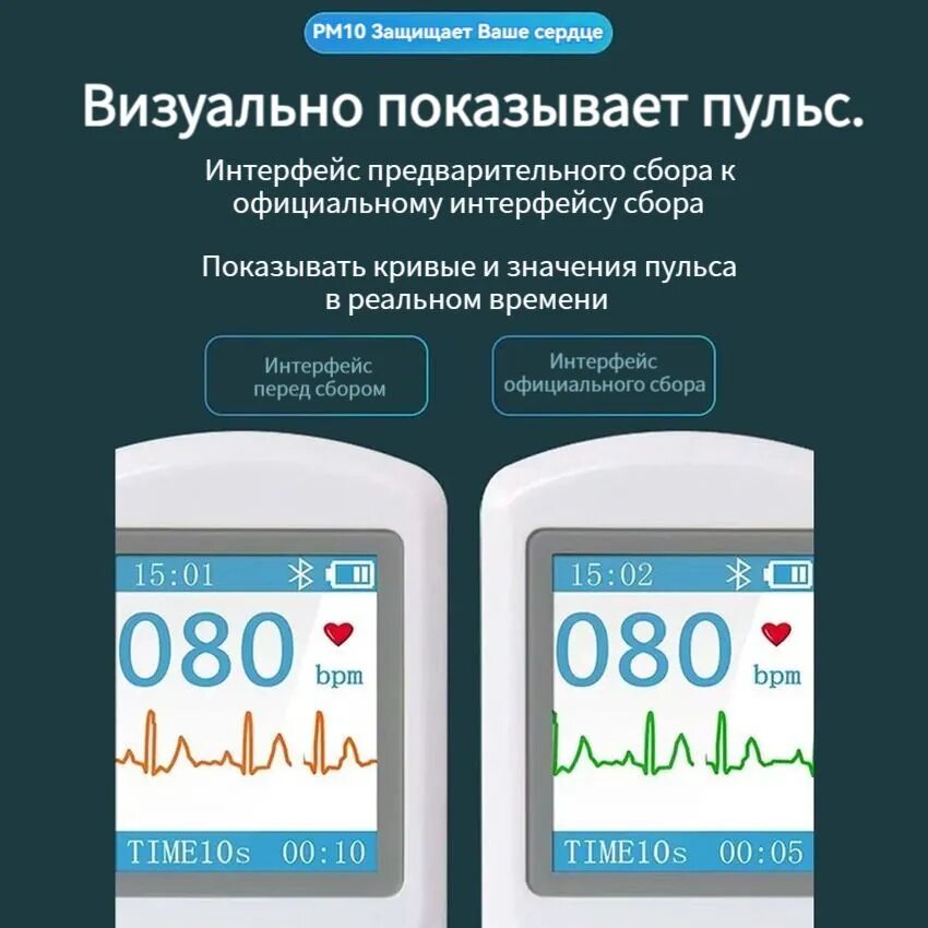 Contec PM10 Портативный монитор ЭКГ с дисплеем OLED, пульсометр, белый, Bluetooth 5.3 — фото 1
