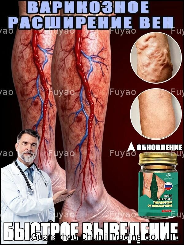 От варикоза ног, для сосудов, отеков и тяжести в ногах, сосудистых звездочек, Эффективен при лечении варикозного расширения вен, 50 мл