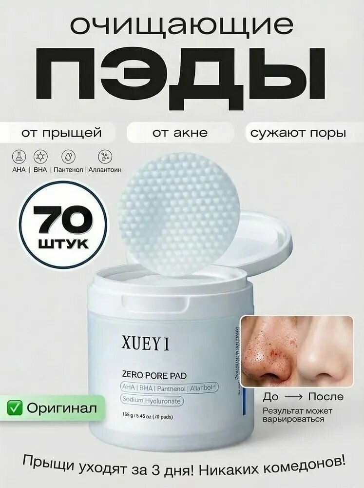 Пэды для отшелушивания кожи от акне 70 шт