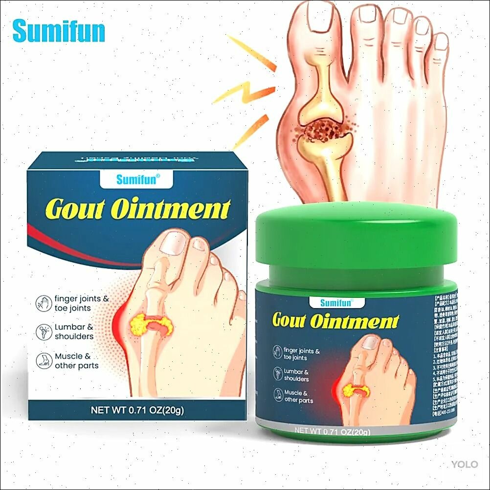 Мазь от пяточной шпоры, болей в пятке и стопе Лечение костей.