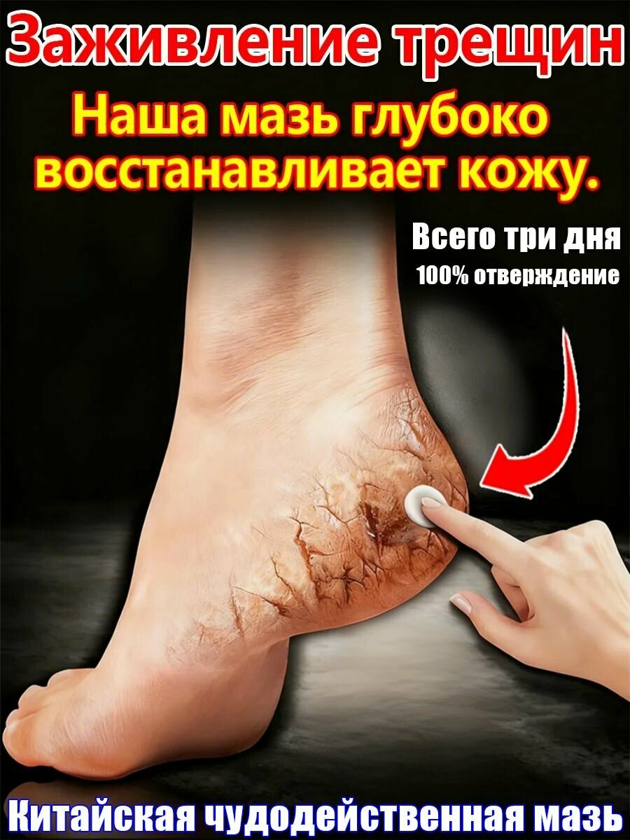 Крем воск от трещин для очень сухой кожи, Мазь для рук, стоп, ступней и всего тела, от трещин на пятках, Китайская чудо-мазь для лечения потрескавшейся кожи, крем от трещин на сосках,20 г