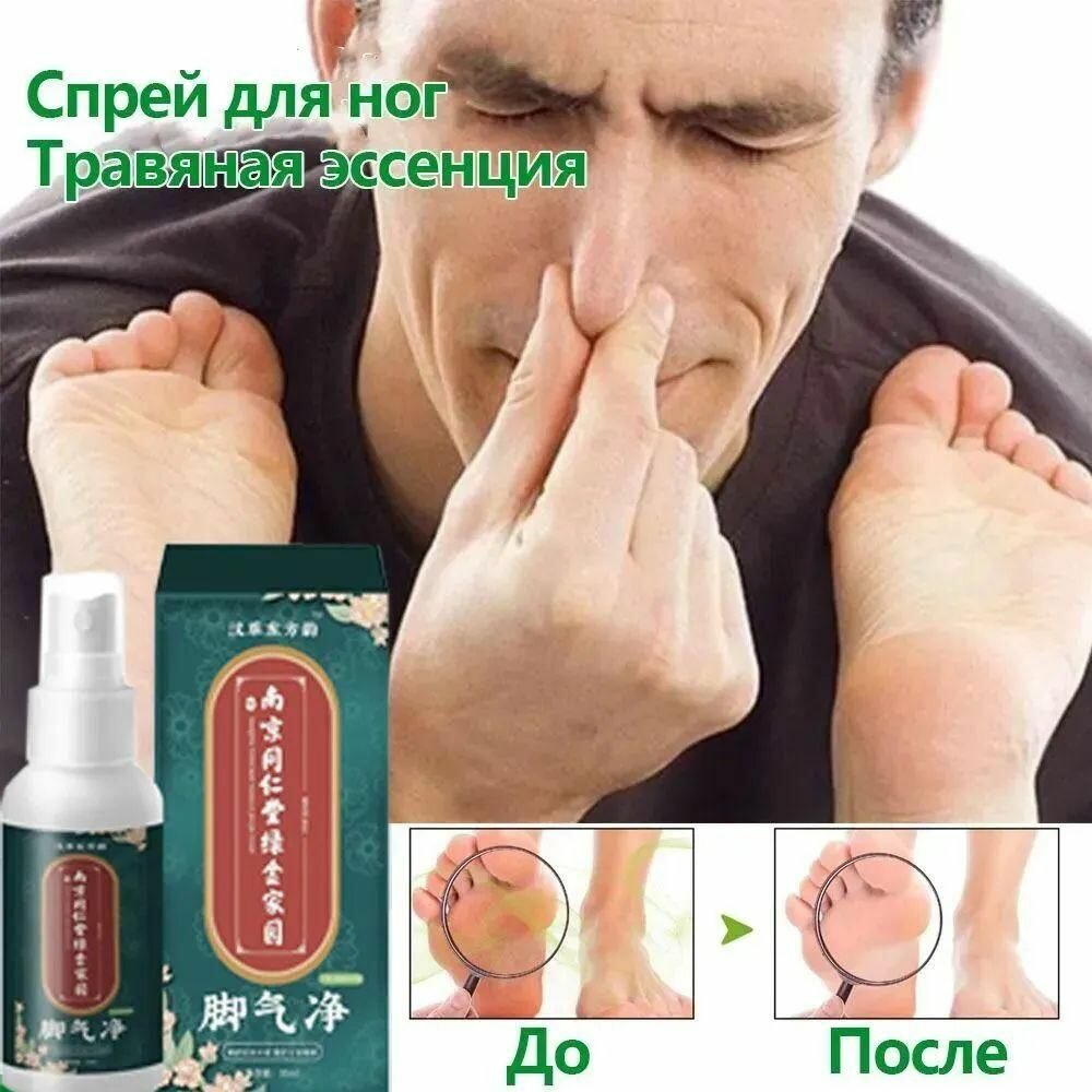 Противогрибковые спреи, мази от трещин на пятках и стопах, псориаза, зуда, микоза, лечение желтых, толстых, пустых и поврежденных ногтей на ногах и их стерилизация