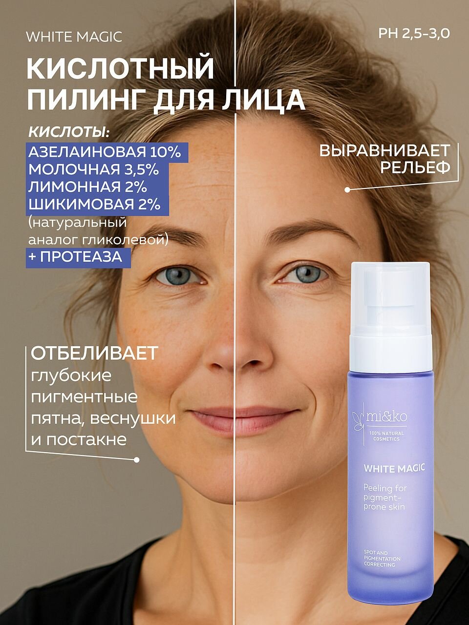 Азелаиновый пилинг для лица от пигментации от постакне от веснушек отбеливающий WHITE MAGIC Miko 50 мл с алазеиновой кислотой, молочной и лимонной