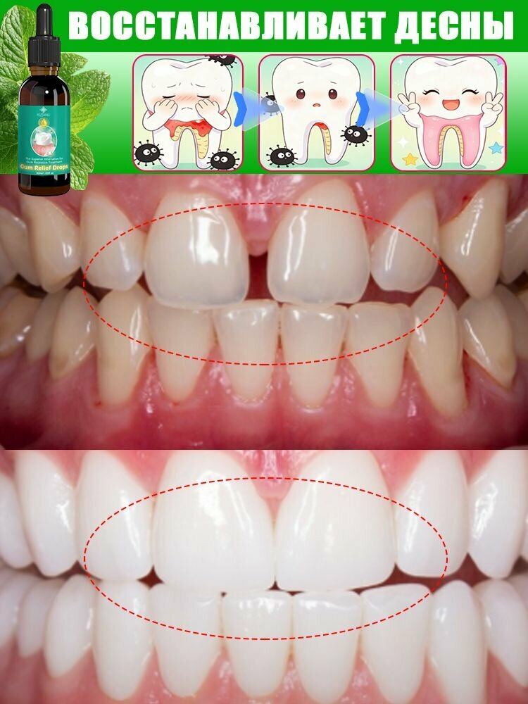 Масло для гигиены полости рта. Быстро лечит опухшие и отступающие десны, пародонтит, снимает чувствительность десен и поддерживает гигиену полости рта. 30 мл