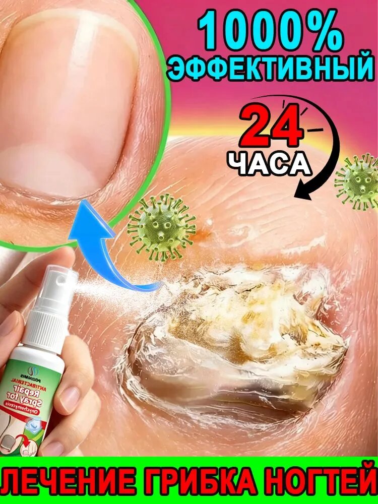 Спрей от грибка ногтей эффективно лечит грибок, уничтожает инфекцию, способствует восстановлению и здоровому росту ногтей, 90 мл