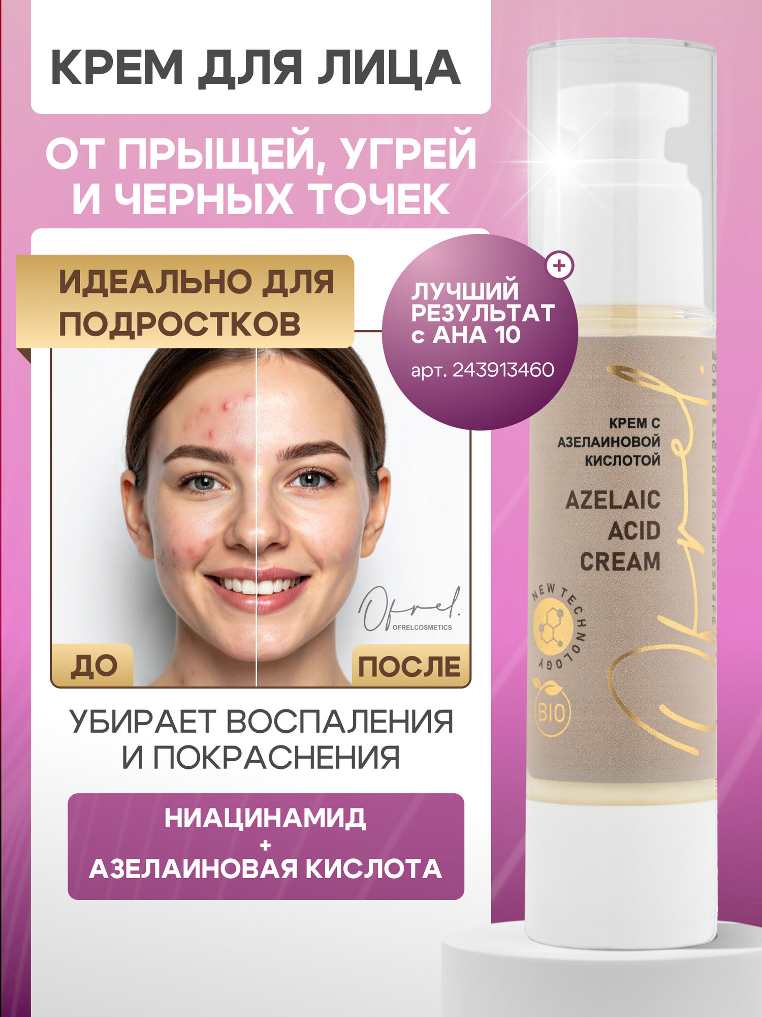 Крем для лица OFRELCOSMETIC, от прыщей, с азелаиновой кислотой, 50 мл