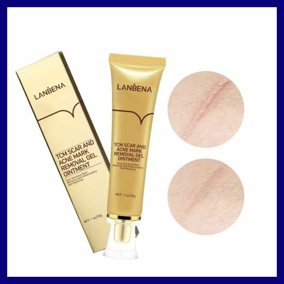 Средство от растяжек