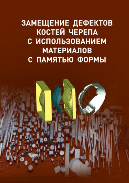 Замещение дефектов костей черепа с использованием материалов с памятью формы [Цифровая книга]