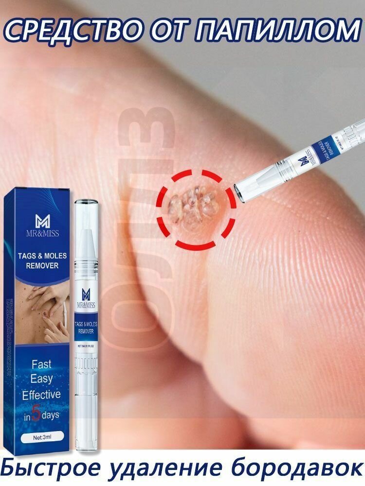 Карандаш от папиллом и бородавок DODOYURI быстрое и безопасное средство для избавления от неприятных образований