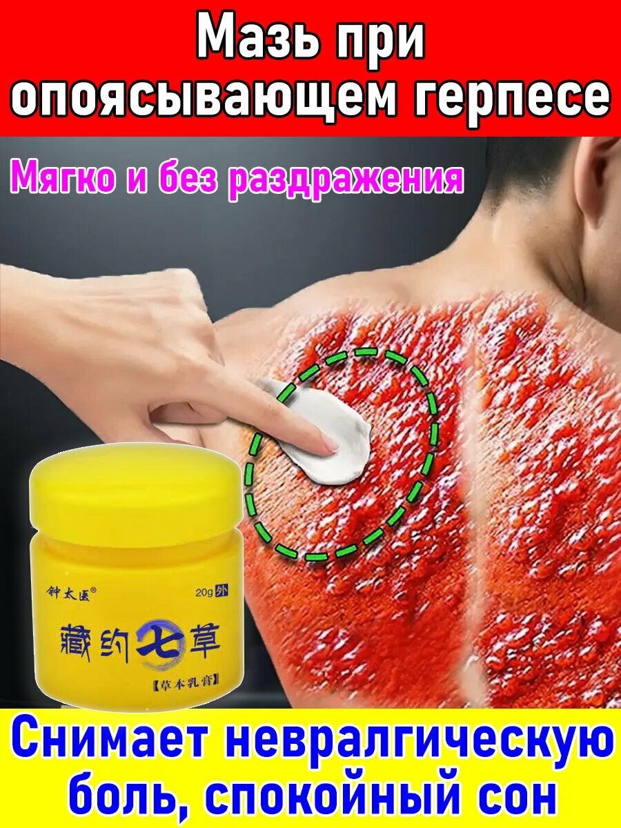 Мазь для лечения опоясывающего лишая