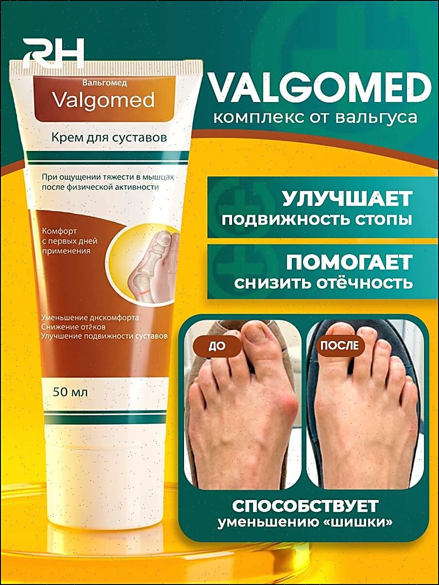 Комплекс для суставов и вальгусе - Valgomed / Вальгомед