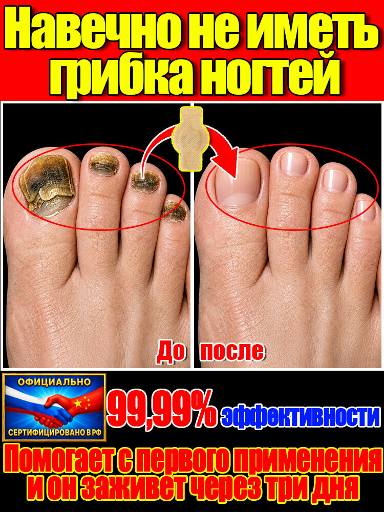 Наклейки для ухода за ногтями, для лечения плесневых инфекций, укрепления ногтей, удаления рогового слоя и устранения онихомикоза.100% эффективны. от грибка ногтей для укрепления ногтей лечение онихомикоза