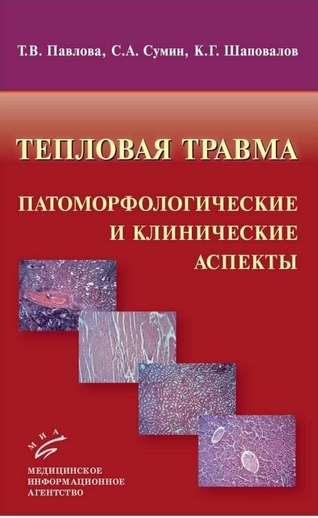 Тепловая травма. Патоморфологические и и клинические аспекты. Павлова
