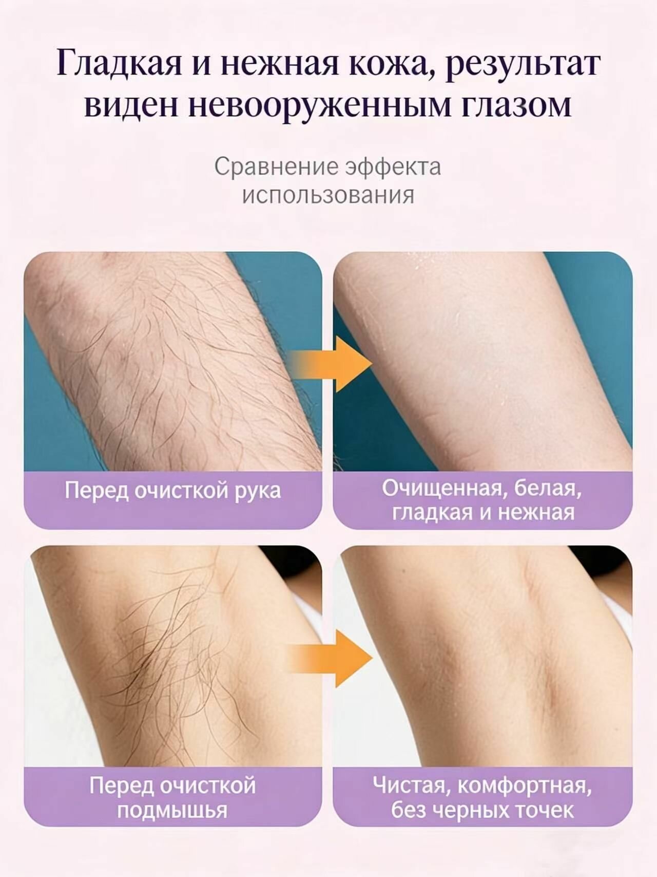 Электрический триммер для удаления волос универсальный для интимных зон, подмышек, рук и ног, для мужчин и женщин