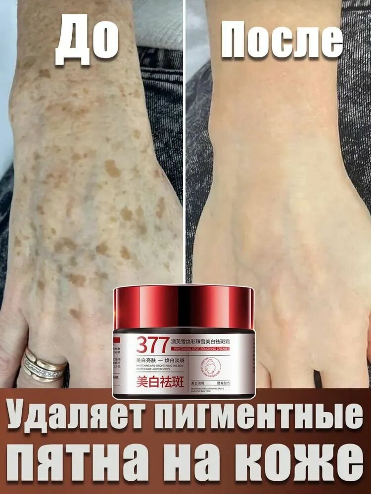 Крем от пигментации для лица, удаляет пигментные пятна, против пигментации, осветляет, для мужчин и женщин, 30 г