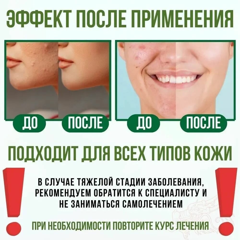 Крем для ухода за кожей