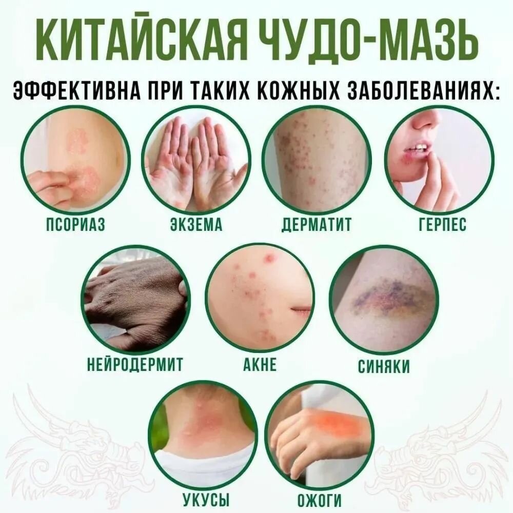 Крем для ухода за кожей